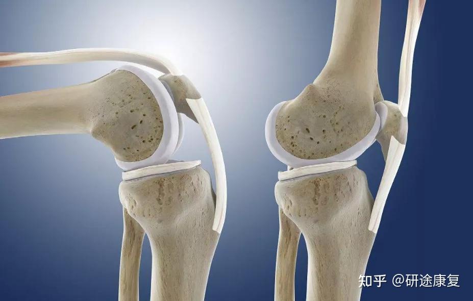 人体最复杂的关节-膝关节 - 知乎