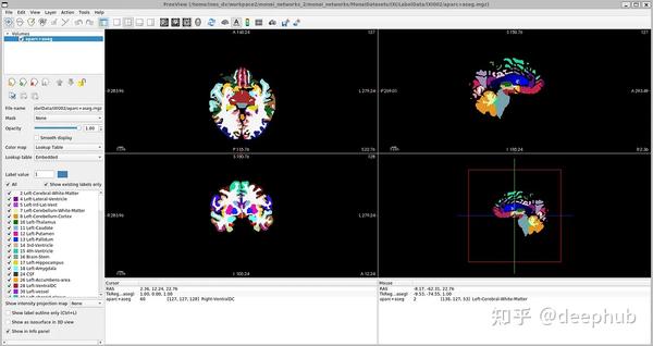 医学图像的深度学习的完整代码示例：使用Pytorch对MRI脑扫描的图像进行分割 - 知乎