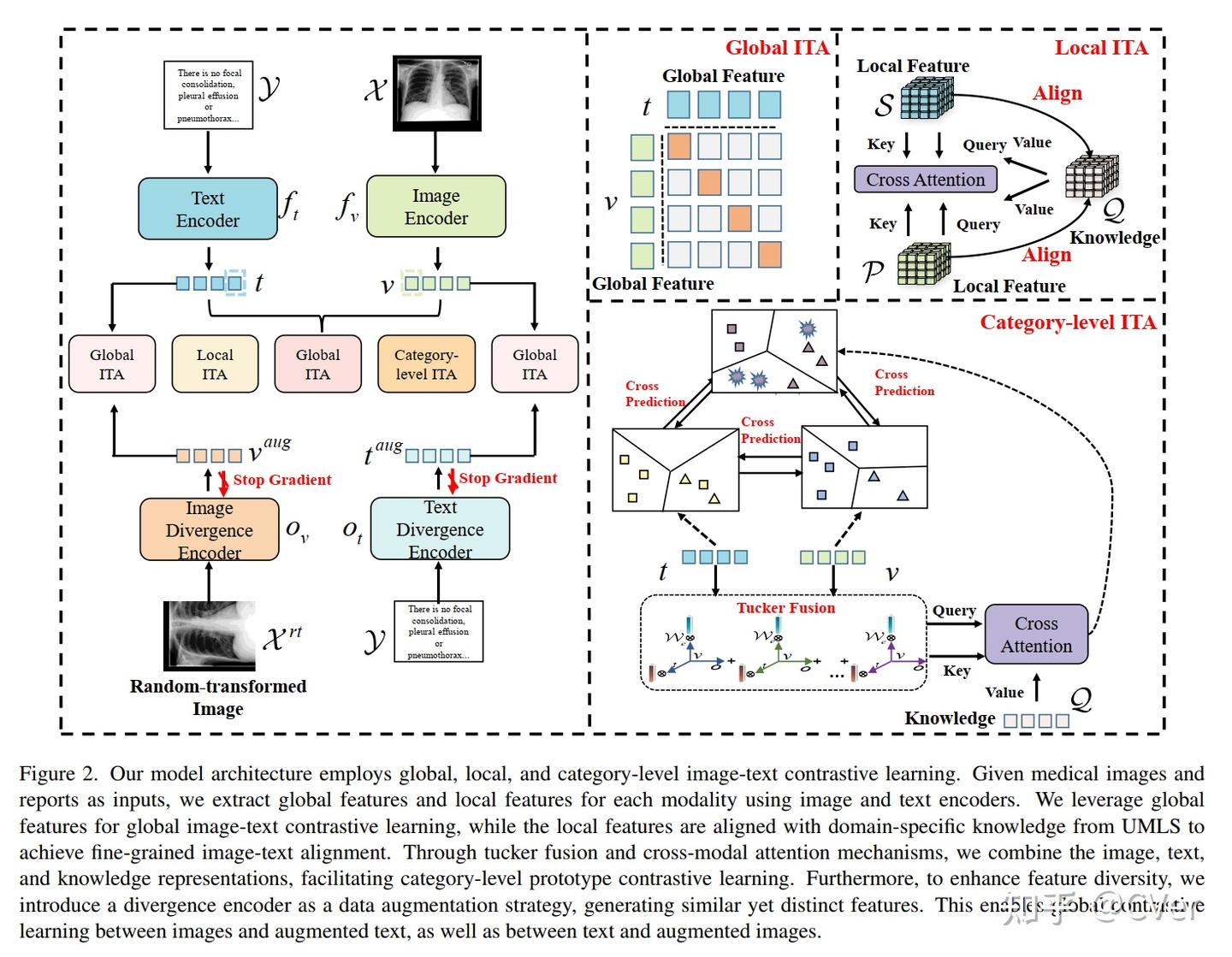 CVPR 2024 | MLIP：增强医学视觉表示！利用发散编码器和知识引导对比学习 - 知乎