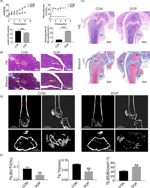 Cell Prolif|肖金刚团队揭示LncRNA-AK137033介导糖尿病性骨质疏松症中脂肪干细胞成骨潜能的作用机制 - 知乎