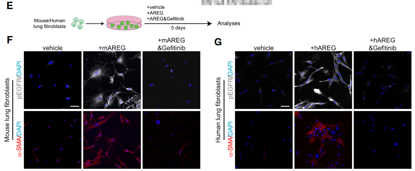 240919 文献精读Plus Cell Stem Cell AREG+肺纤维化 - 知乎