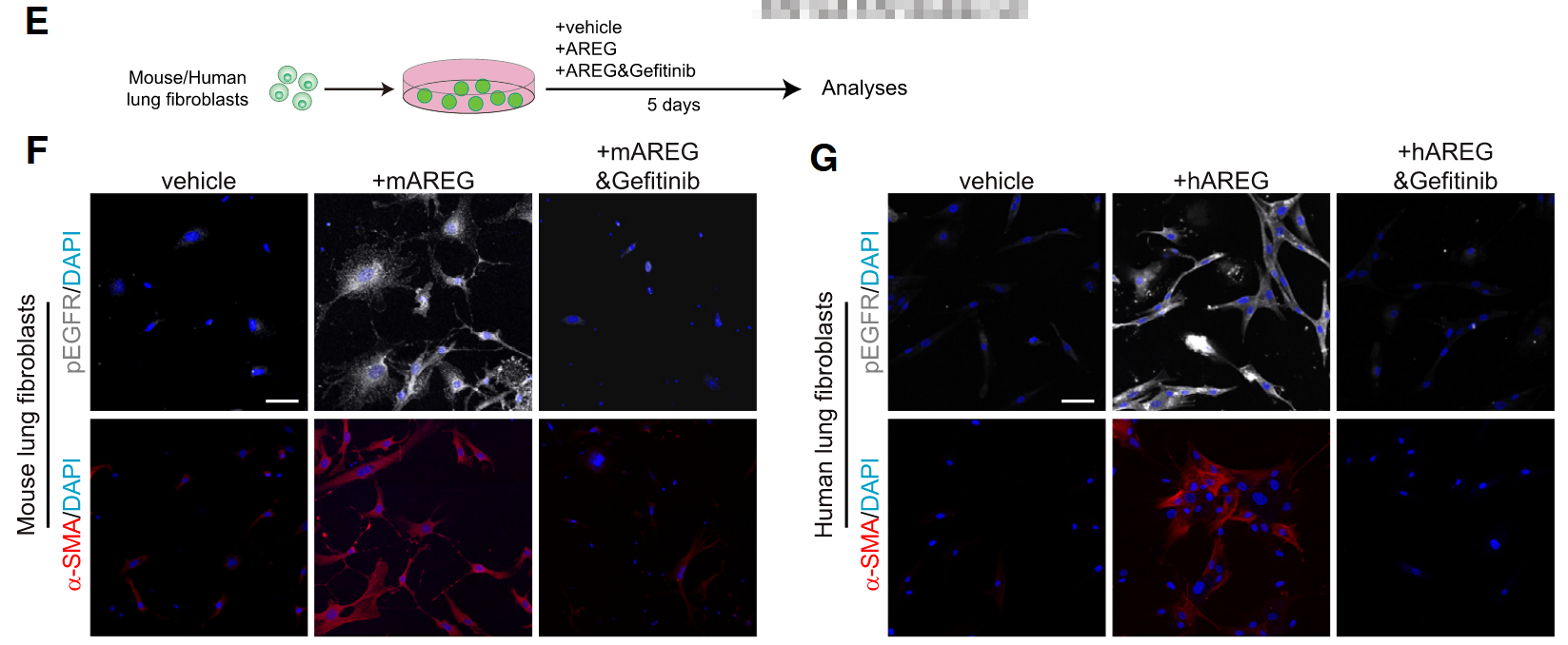 240919 文献精读Plus Cell Stem Cell AREG+肺纤维化 - 知乎