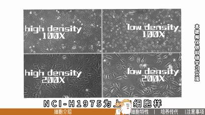 NCI-H1975细胞培养，人肺腺癌细胞培养攻略 - 丰晖生物 - 知乎