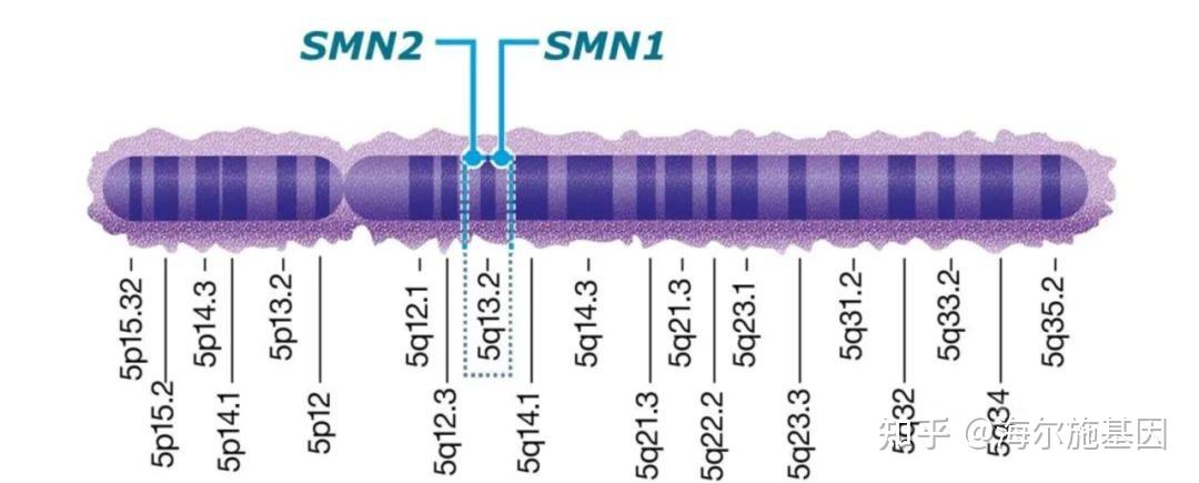 玩转Sanger测序仪｜专题二：脊髓性肌肉萎缩症（SMA）检测 - 知乎