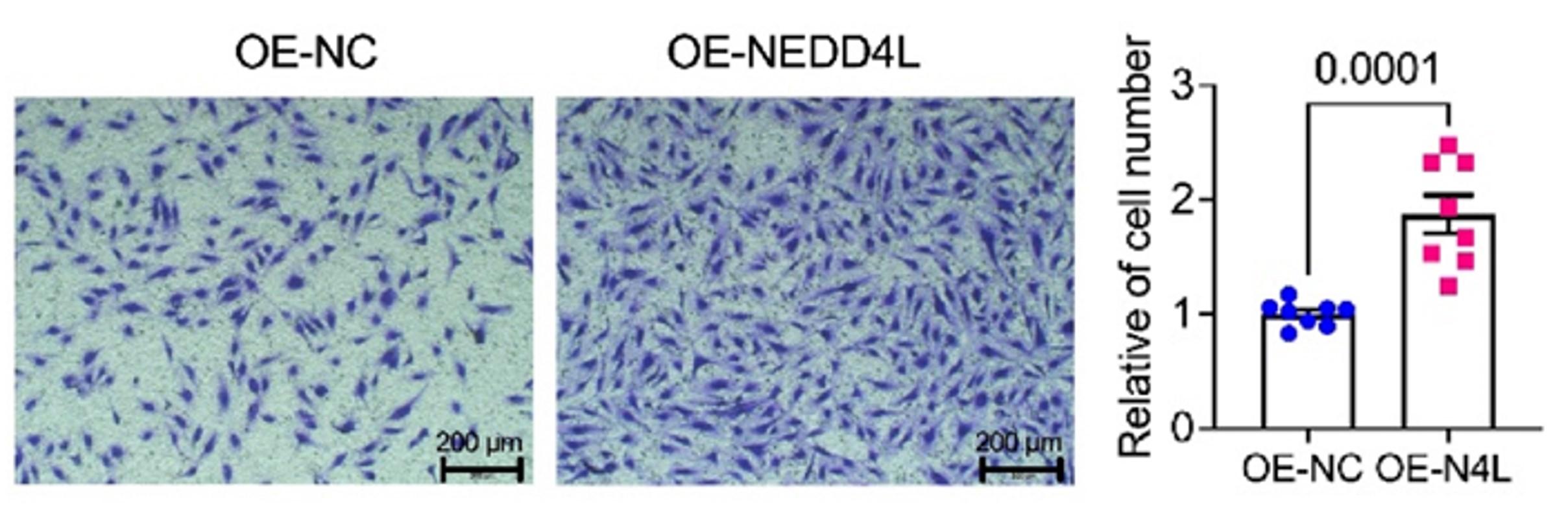 细胞功能实验那些事∣细胞迁移和侵袭（3）之Transwell实验 - 知乎