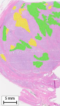 Nature Medicine｜Towards a general-purpose foundation model for computational pathology 论文分享 - 知乎