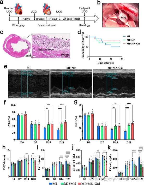 《ACS AMI》：负载 Galunisertib 的GelMA水凝胶微针贴片，用于心肌梗塞后的心脏修复 - 知乎
