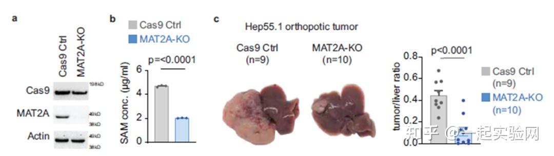 肿瘤蛋氨酸代谢驱动肝细胞癌T细胞耗竭 - 知乎