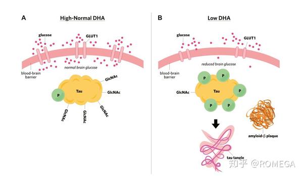 最新研究：磷脂DHA如何预防与改善阿尔茨海默氏病？ - 知乎