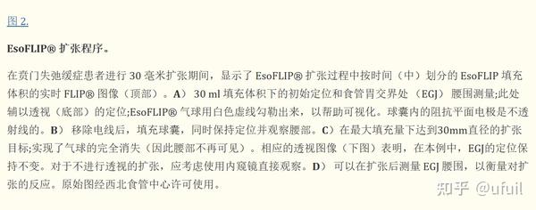胃肠动力：EsoFLIP（食管 FLIP ）用于食管扩张：建议的优势 - 知乎