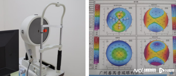 刘泉教授团队建立圆锥角膜辅助诊断系统，AI准确率与高年资医生相当 - 知乎