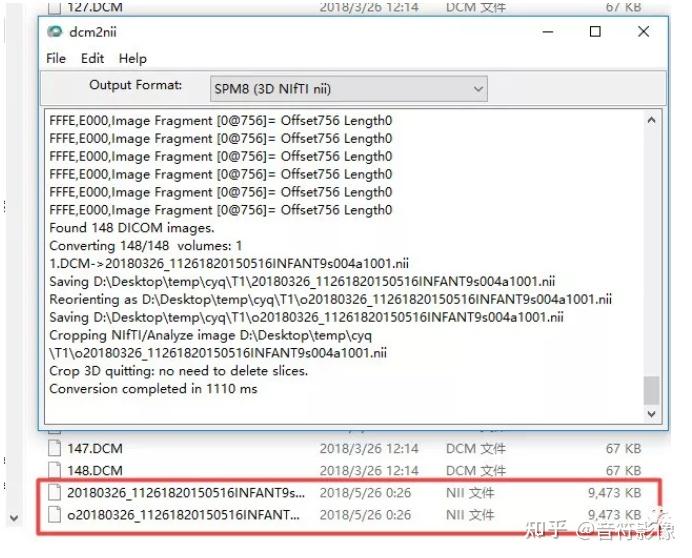 基于SPM的多模态神经影像配准方法 - 知乎