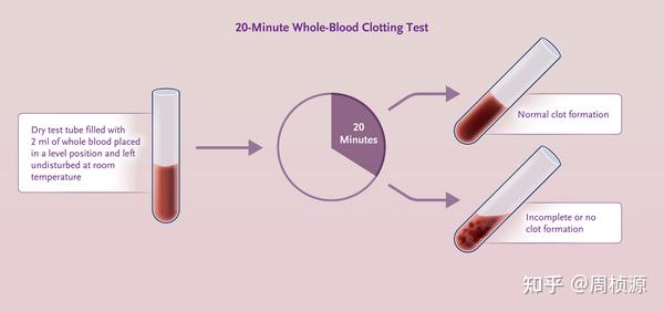 Nejm 2024 Case 1 - 知乎