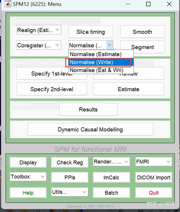 3-spm-fMRI任务态数据分析——预处理（下） - 知乎
