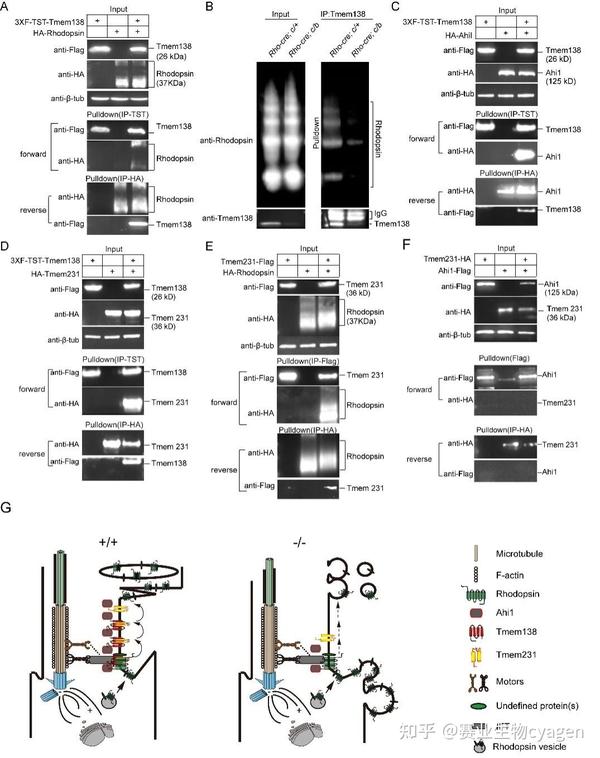 中山大学中山眼科中心刘春巧教授团队揭示光感受器外段蛋白转运新机制 - 知乎