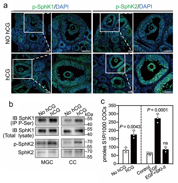 Cell Death Dis︱张美佳/苏友强课题组合作揭示鞘氨醇-1-磷酸（S1P）促进小鼠卵母细胞成熟的分子机制 - 知乎