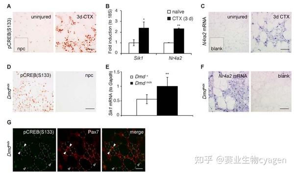 一文带你了解Creb1基因——研究神经系统及肌肉再生的关键基因 - 知乎