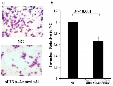 Transwell实验---从入门了解到SCI写作 - 知乎