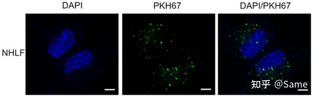 PKH67细胞膜绿色荧光探针 - 知乎