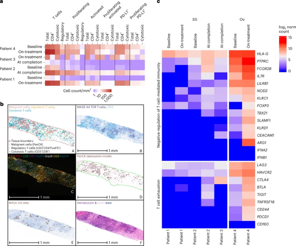Nat Med | 增强型T细胞临床实验对多种实体瘤有效并且毒性可控 - 知乎