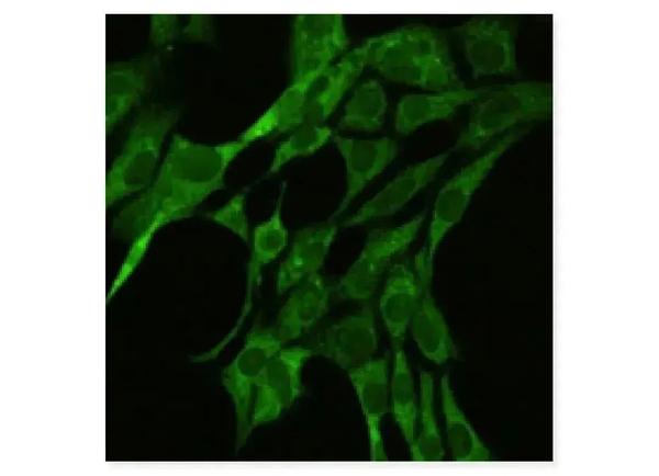 一抗二抗傻傻分不清？如何选择抗体？| MCE - 知乎