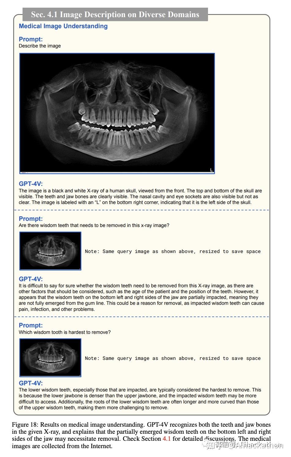 必看：微软166页论文解读 GPT-4V 全文翻译《多模态的新时代》The Dawn of LMMs: Preliminary ...