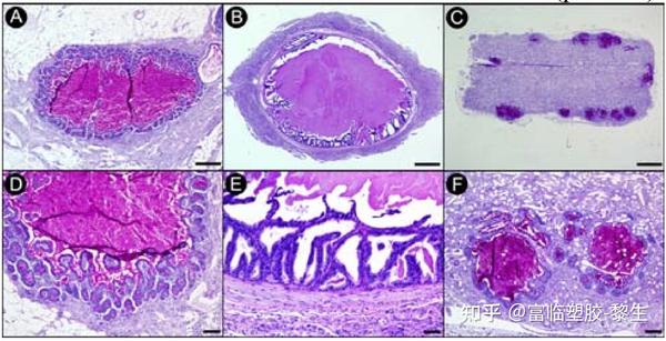 Confluent PGA医用无纺布Biofelt - 知乎