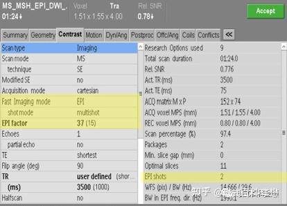 IRIS：多激发SE-EPI扩散（弥散）序列 - 知乎
