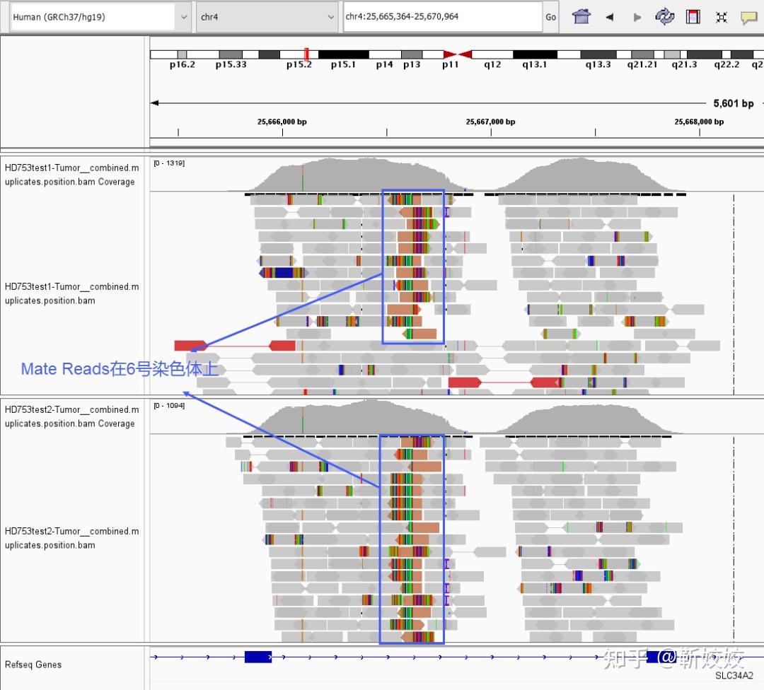 IGV快速上手指南（四）——查看基因融合 - 知乎