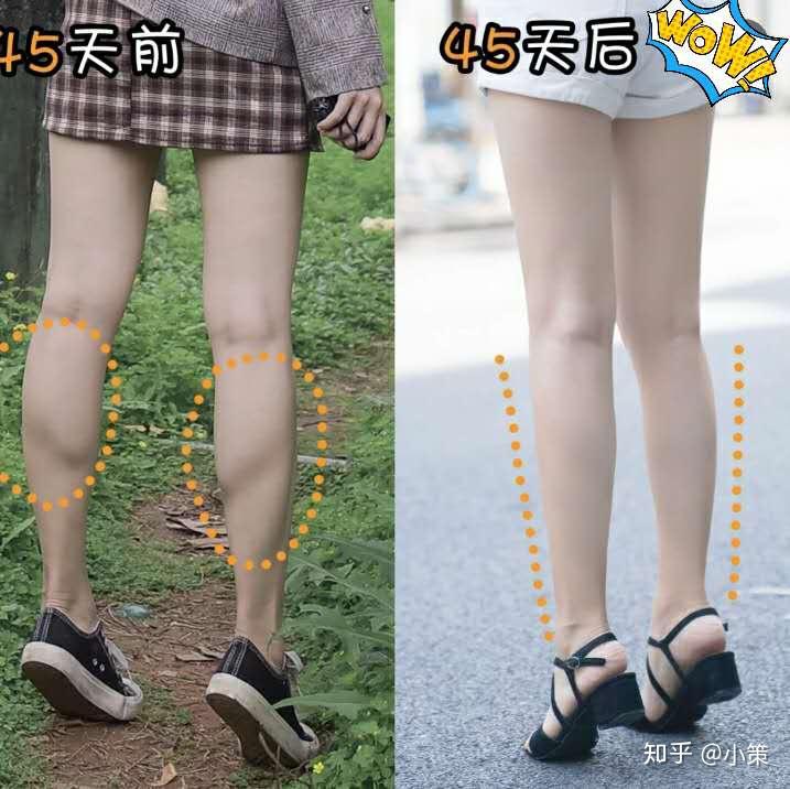 小腿和大腿一样粗怎么减? 知乎