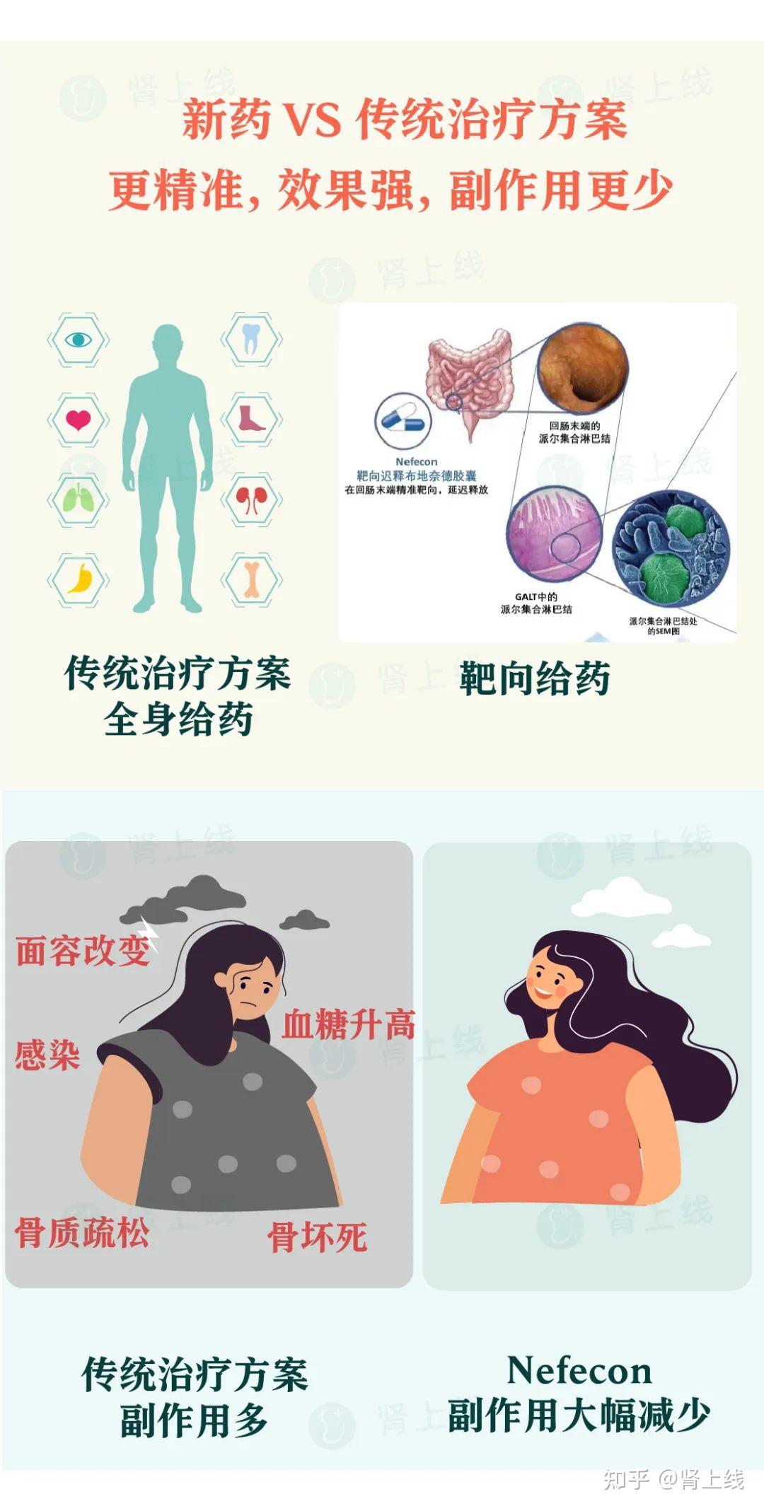 全球首个 IgA 肾病靶向治疗药物，3期临床结果公布，停药后效果非常好！ - 知乎