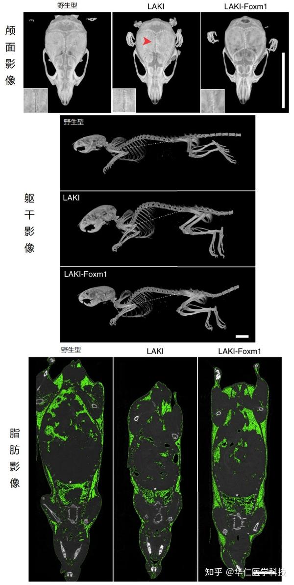 抗衰老研究的新靶点——FOXM1 - 知乎