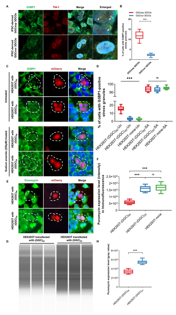 项目文章 | 单细胞测序揭示NOTCH2NLC基因GGC重复扩增导致核糖体生物生成及翻译障碍 - 知乎