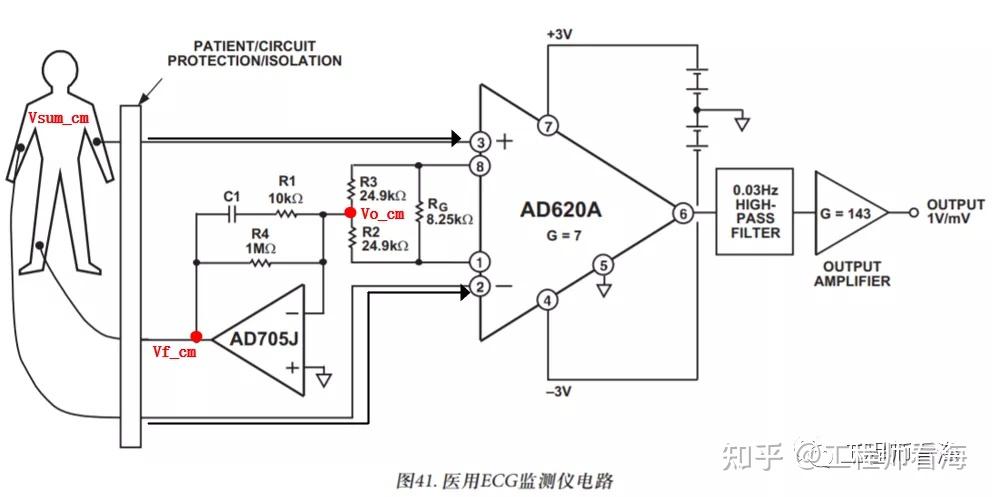 右腿驱动电路原理？心电采集必备，有仿真文件！ - 知乎