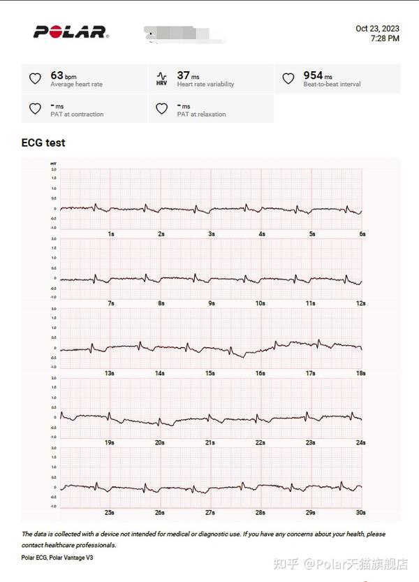 Polar Vantage V3 新功能之一：腕式ECG - 知乎