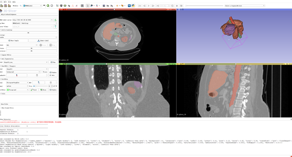 MONAI_Label 安装试用 - 知乎