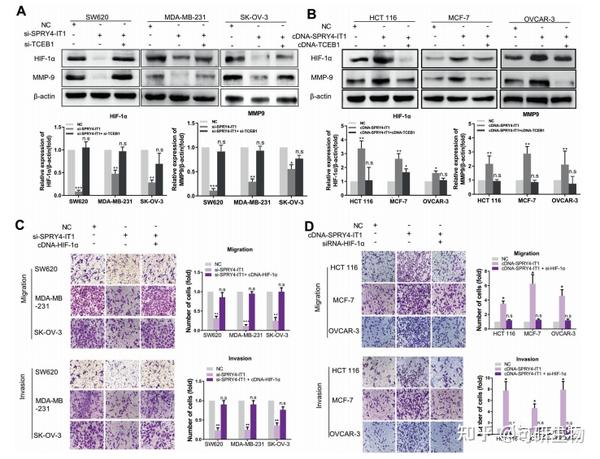 NF-κB激活的SPRY4-IT1下调TCEB1 mRNA促进癌细胞转移 - 知乎