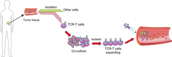免疫治疗之 TCR-T - 知乎