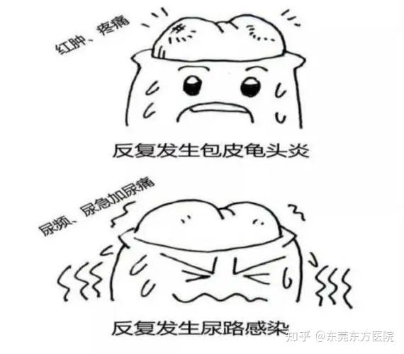 30岁了,割包皮还有用吗?答案在这~ 知乎